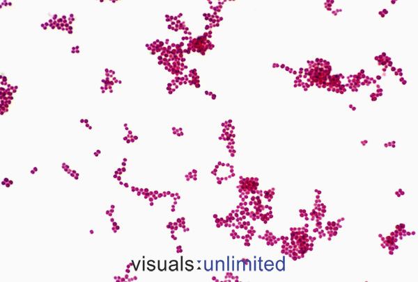 Coccobacillus - Alchetron, The Free Social Encyclopedia