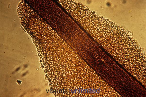 Trichosporon beigelii - Alchetron, The Free Social Encyclopedia